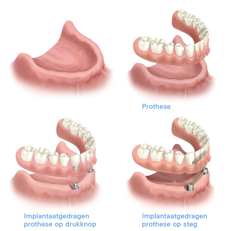 behandelingen | Dental Clinic Rumbeke